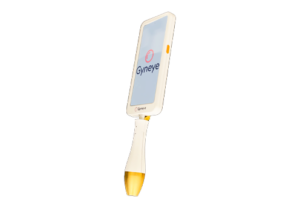 Gyneye smart colposcope | Product | globally acclaimed