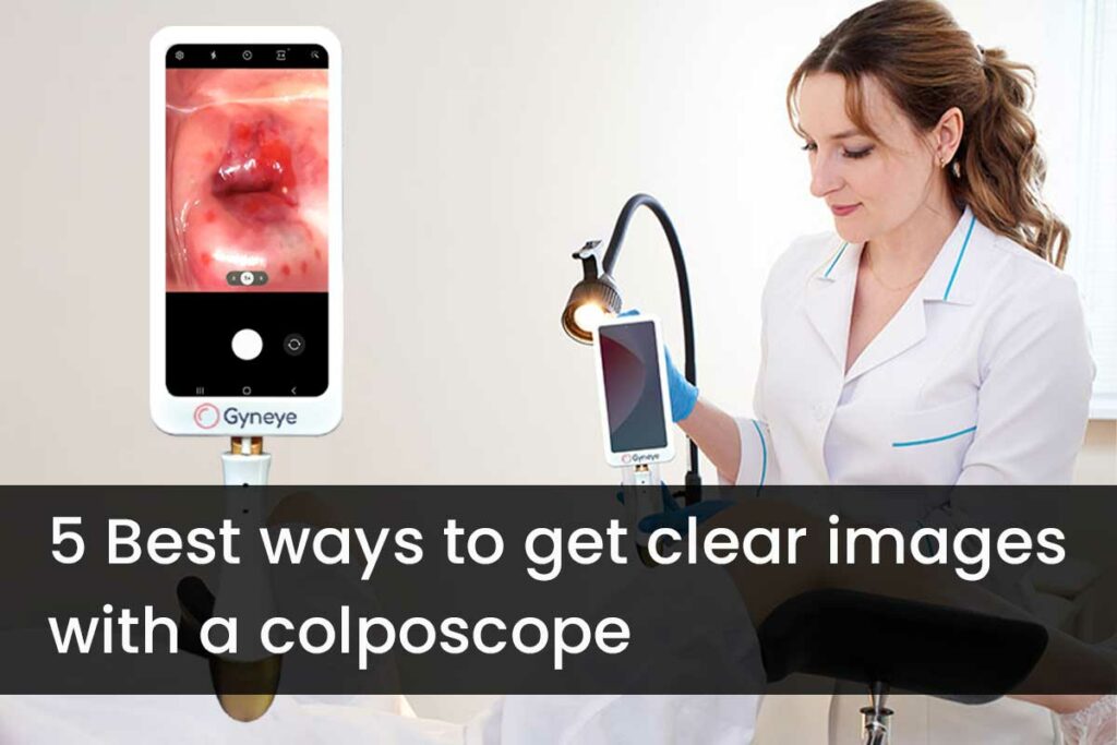 Five Best Ways To Get Clear Images With Colposcope | GynEye