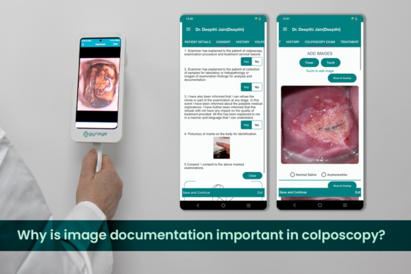 Why is image documentation important in colposcopy? - Gyneye
